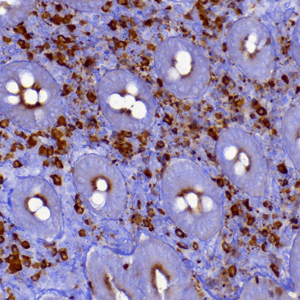 Appendix stained with Anti-Lambda Light Chain