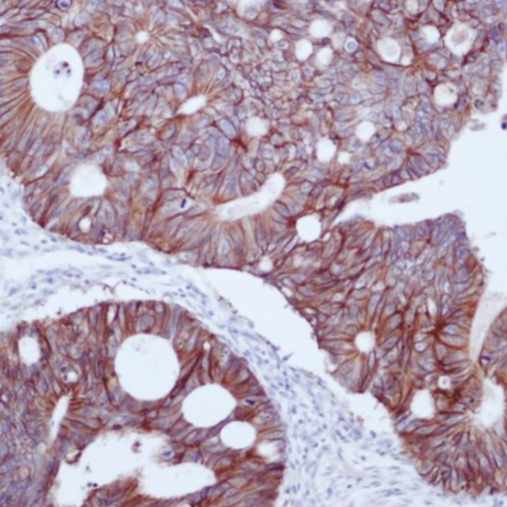 EP-Cam-Ber-EP4 | PathnSitu Biotechnologies