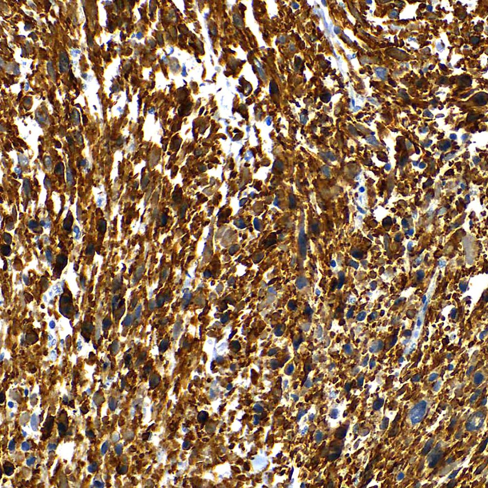 Alpha-Actin|PathnSitu Biotechnologies