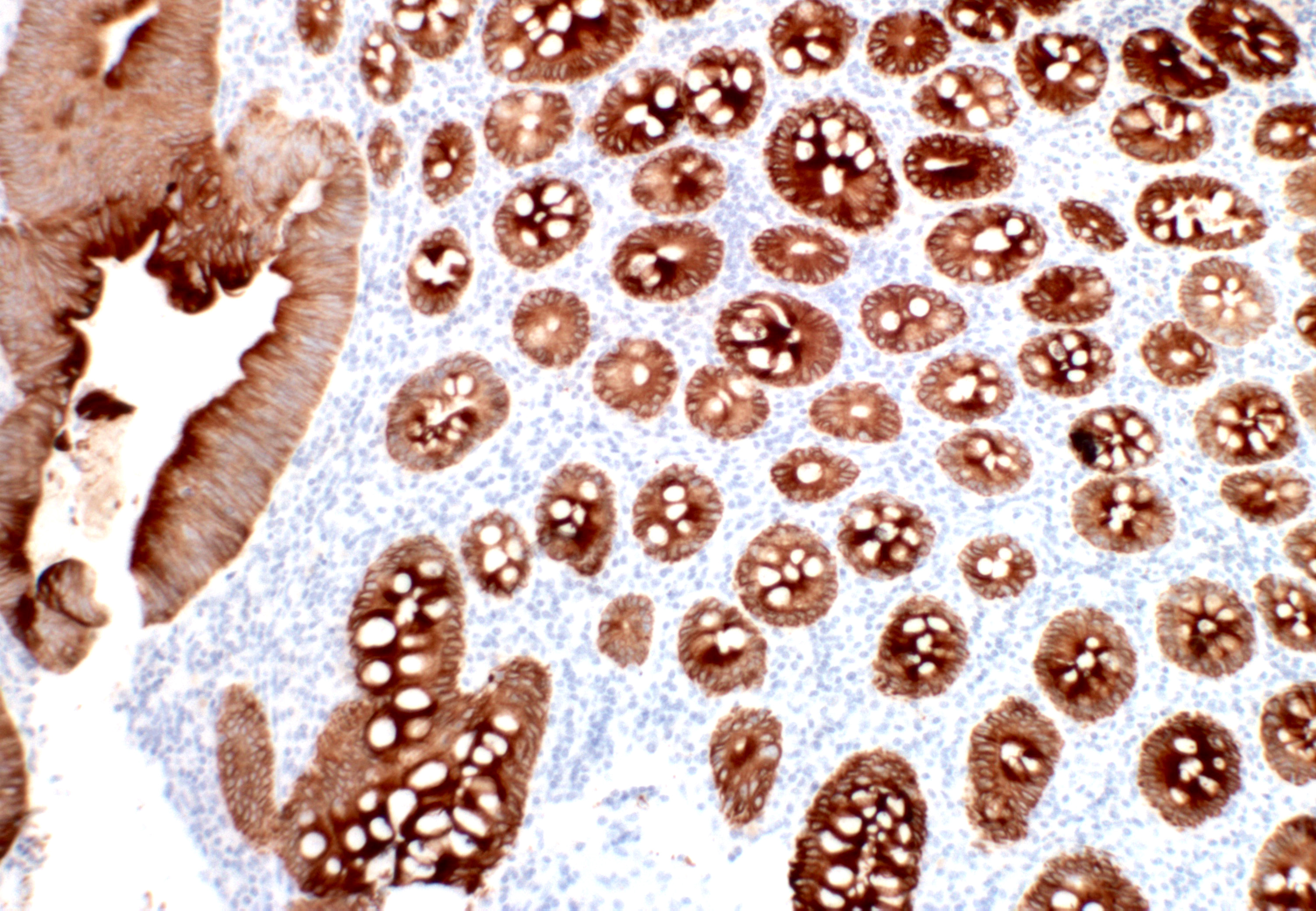 Cytokeratin-AE1/AE3 | PathnSitu Biotechnologies