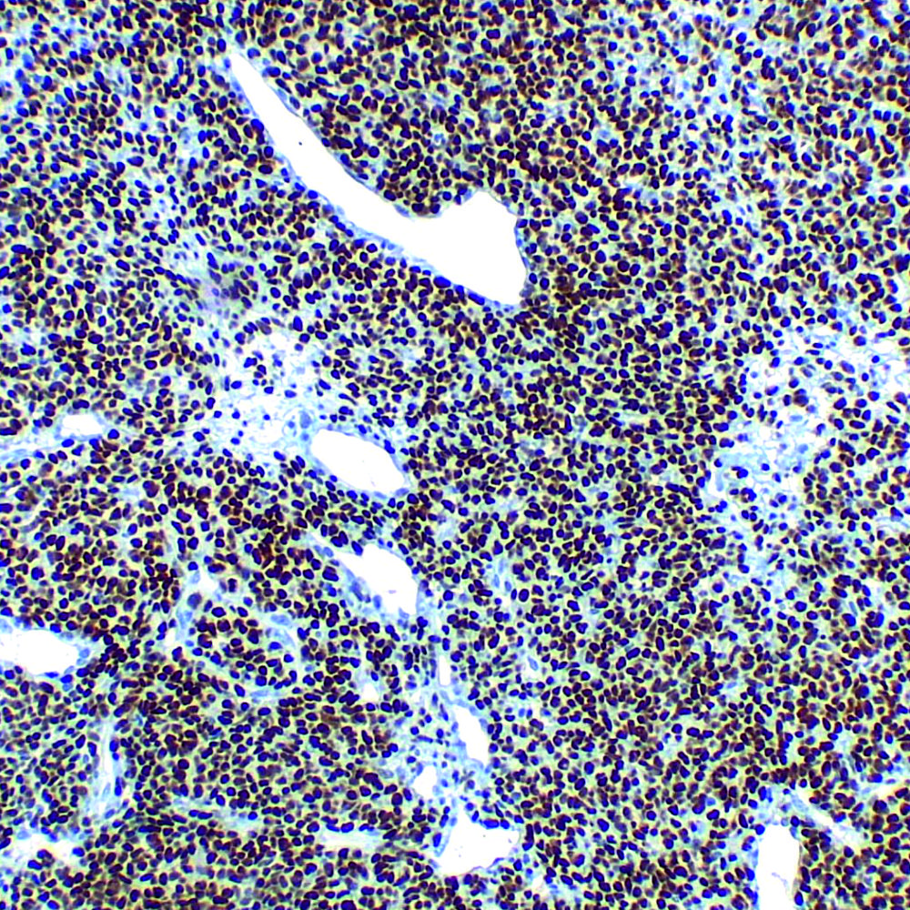 TFE1-1F5 | PathnSitu Biotechnologies