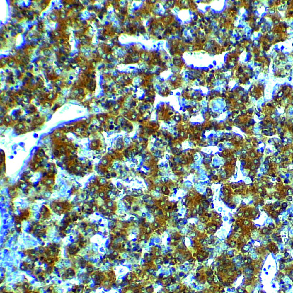 AFP antibody-Poyclonal| PathnSitu