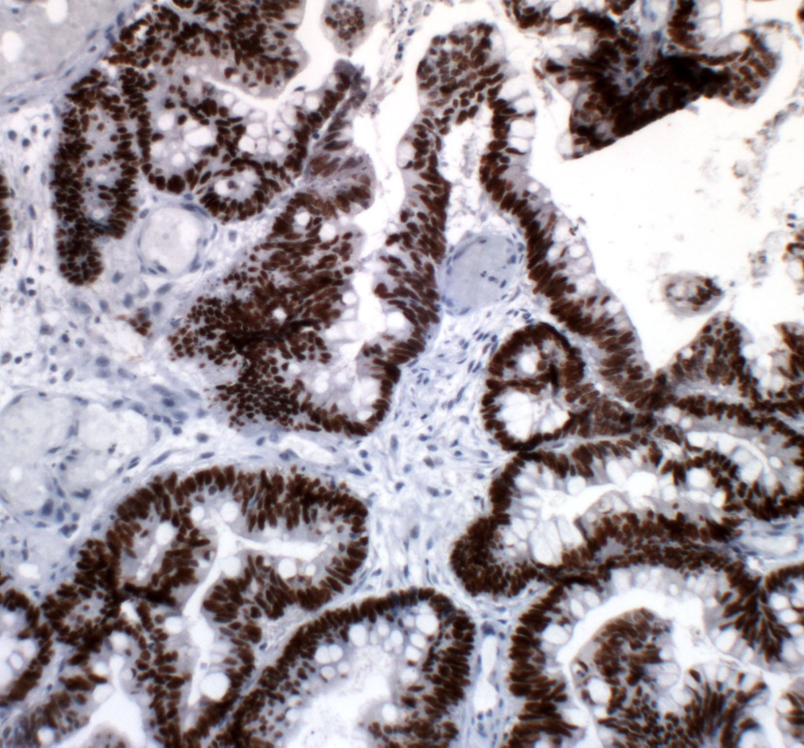 SATB2-EP281 | PathnSitu Biotechnologies