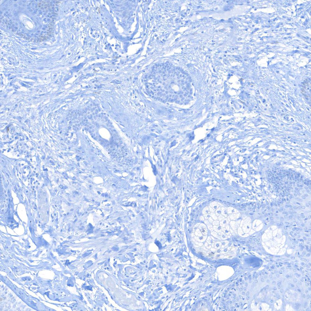 Skin (neg) stained with Anti-ACE2