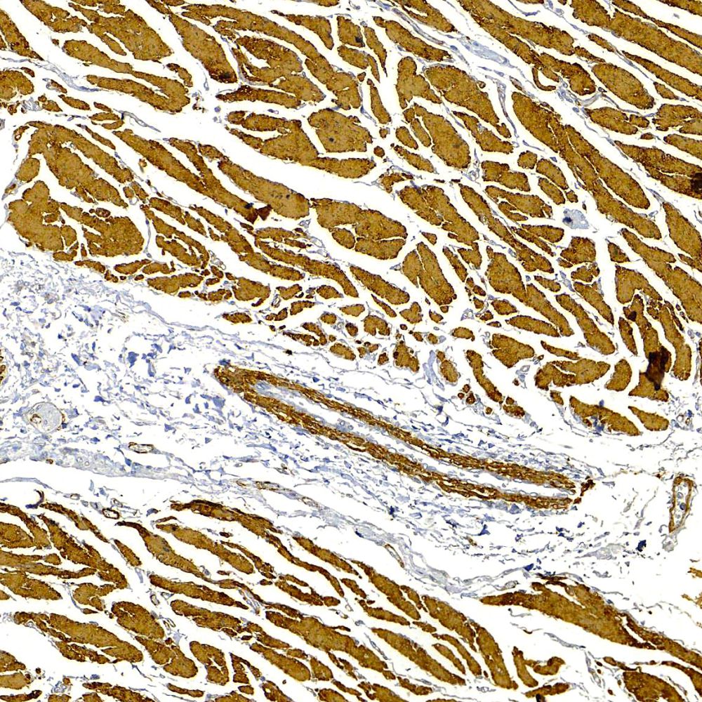 Alpha-Actin|PathnSitu Biotechnologies