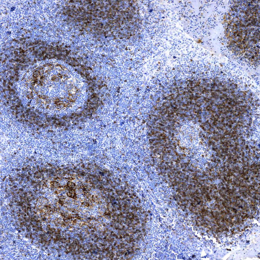 Tonsil Stained with Anti-CD23