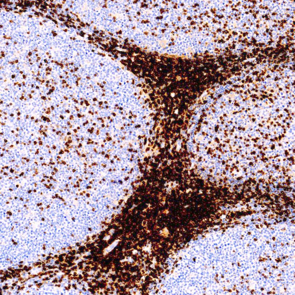 Tonsil stained with Anti-CD7
