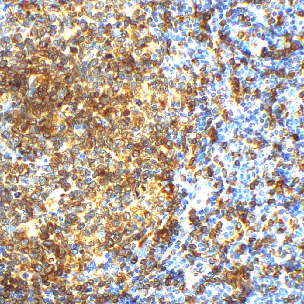 CD74-EP167 | Pathnsitu Biotechnologies