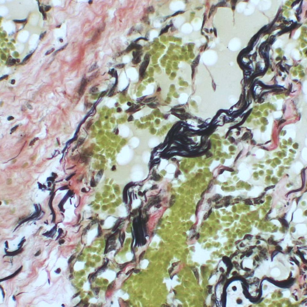 Verhoeff-Vangieson Stain_3 stained on Normal lung