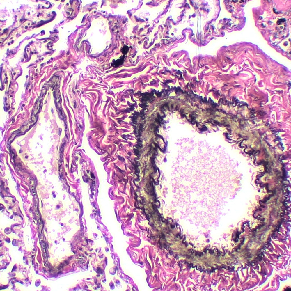 Verhoeff-Vangieson Stain_1 stained on Normal lung