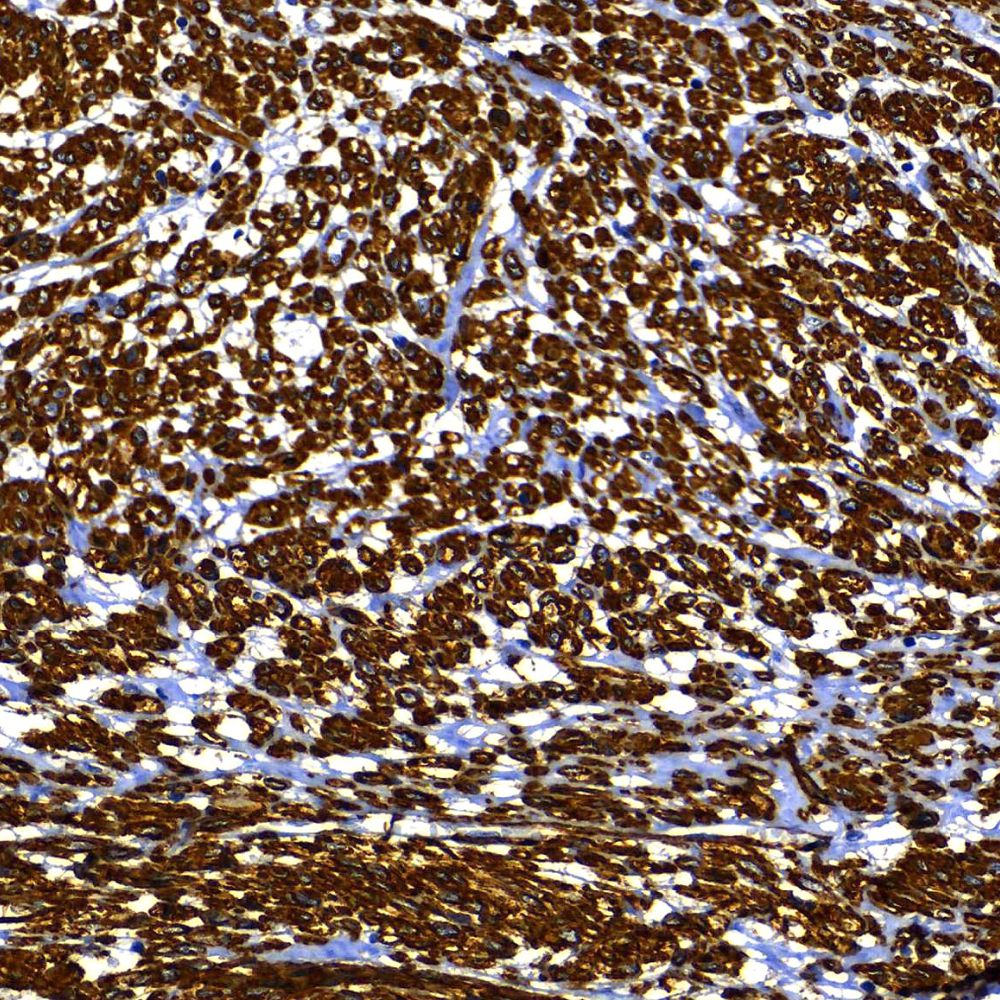 Actin - 1A4|PathnSitu